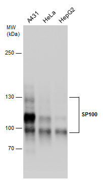 Anti-SP100 antibody (GTX131570) | GeneTex