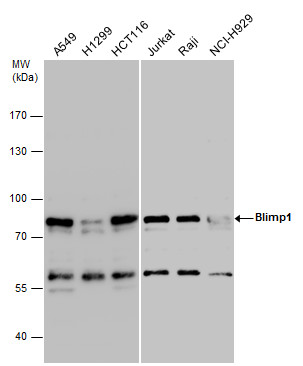 Anti-Blimp1 antibody (GTX132087) | GeneTex