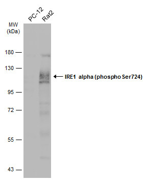 Anti-IRE1 alpha (phospho Ser724) antibody (GTX132808) | GeneTex