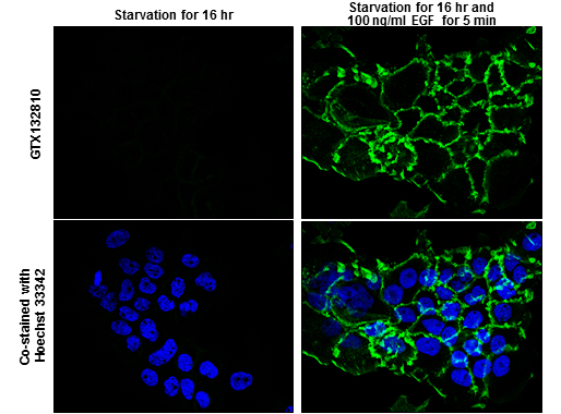EGFR (phospho Tyr1068) antibody价格,详情介绍-960化工网 – 960化工网