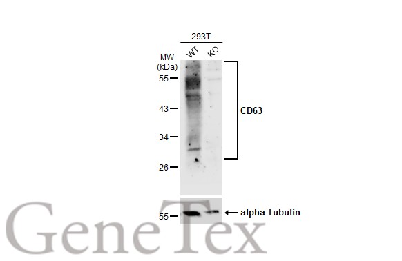 Anti-CD63 antibody (GTX132953) | GeneTex