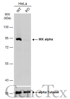 Anti-IKK alpha antibody (GTX132964) | GeneTex