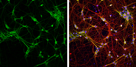 Anti-MAP2 antibody (GTX133109) | GeneTex