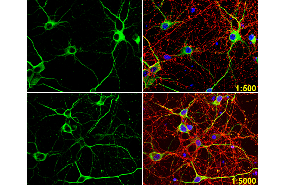 Anti-MAP2 antibody (GTX133109) | GeneTex
