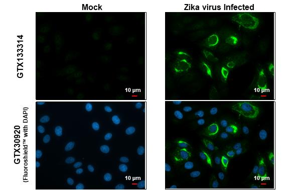 Anti-Zika virus Envelope protein antibody (GTX133314) | GeneTex
