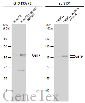 Anti-UBTF antibody (GTX133773) | GeneTex