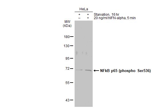Anti-NFkB p65 (phospho Ser536) antibody (GTX133899) | GeneTex