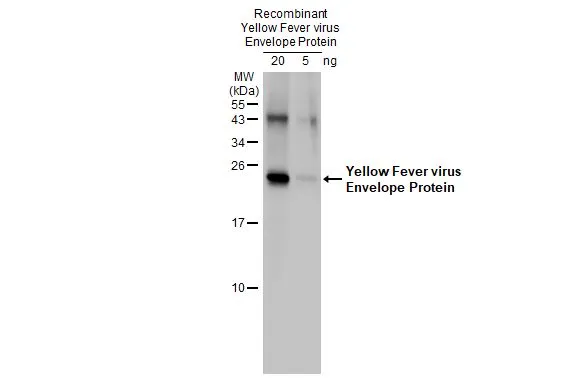Anti-Yellow Fever virus Envelope Protein antibody (GTX134024) | GeneTex