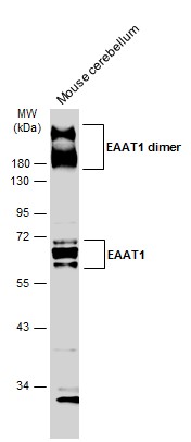 Anti-EAAT1 antibody (GTX134059) | GeneTex