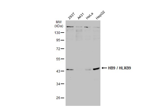 Anti-HB9 / HLXB9 antibody (GTX134781) | GeneTex