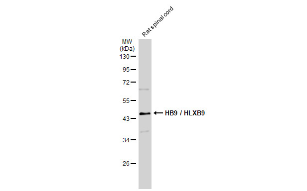 Anti-HB9 / HLXB9 antibody (GTX134781) | GeneTex