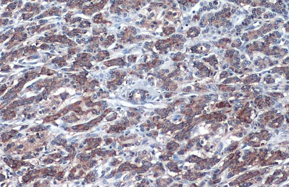 Anti-CDKN2A / p16INK4a antibody (GTX135120) | GeneTex