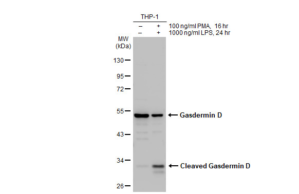 Anti-Gasdermin D antibody (GTX135366) | GeneTex