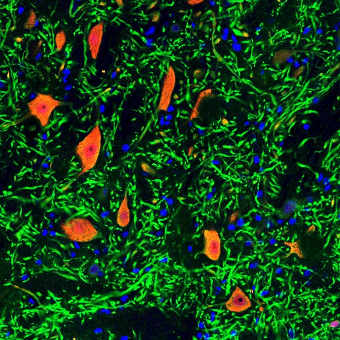 Anti-NeuN antibody (GTX16208) | GeneTex
