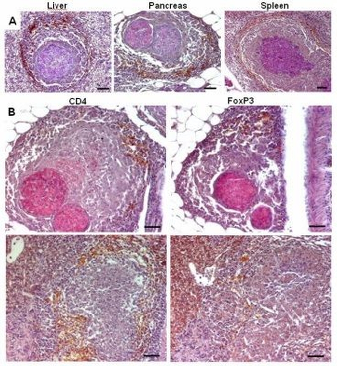 Anti-Cd4 antibody (GTX16589) | GeneTex