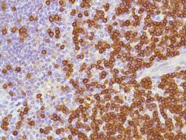 Anti-CD3 antibody [SP7] (GTX16669) | GeneTex