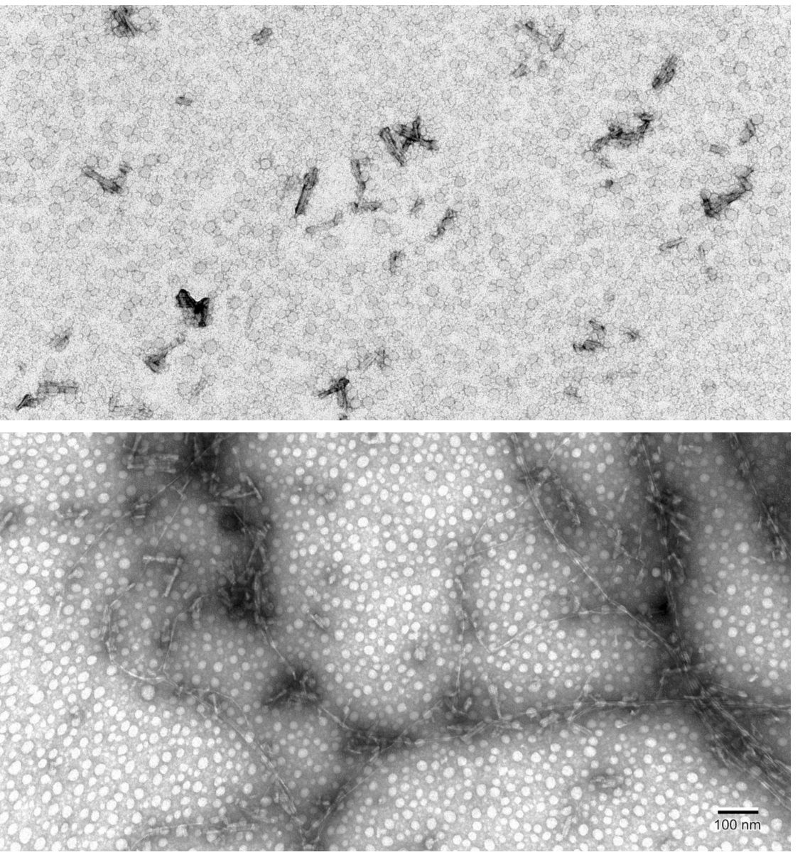 Human alpha Synuclein protein (Pre-Formed Fibrils) (GTX17667-pro) | GeneTex
