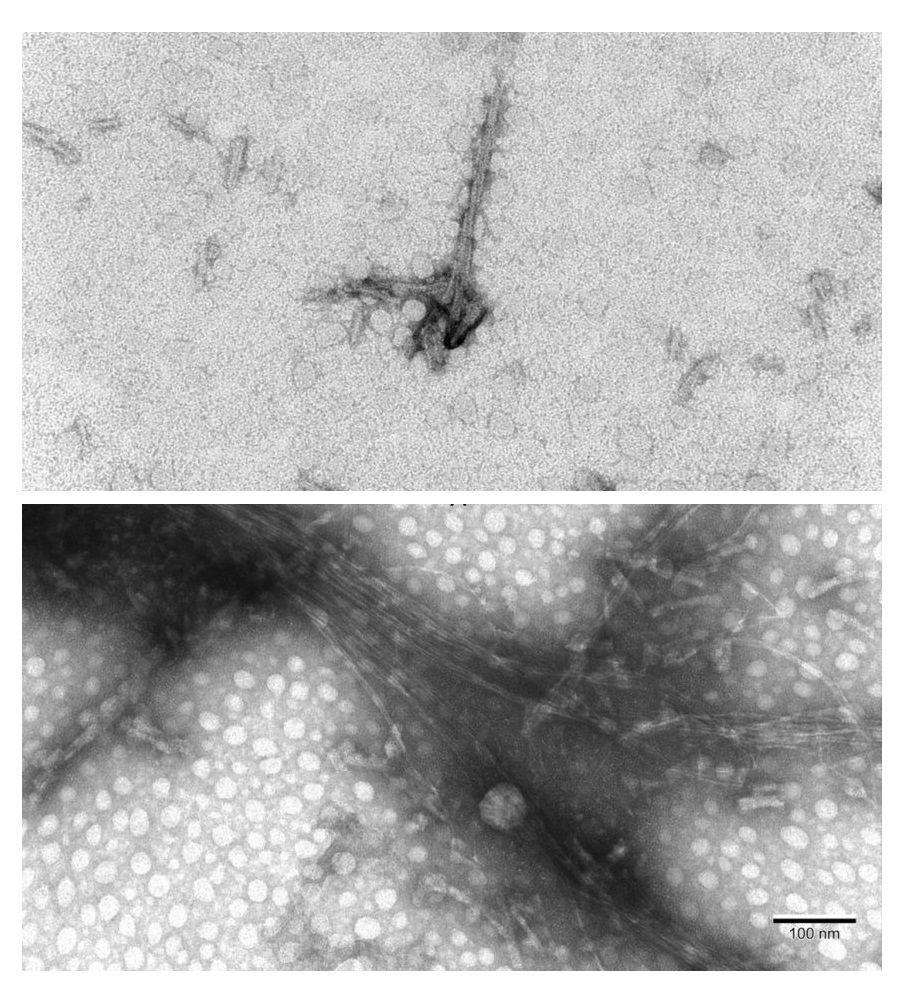 Human alpha Synuclein protein (active, Pre-Formed Fibrils) (GTX17669 ...