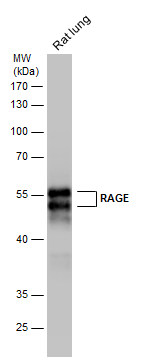 Anti-RAGE antibody (GTX23611) | GeneTex