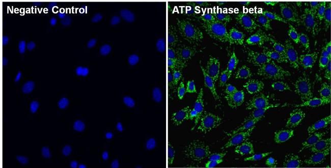 Anti-ATP5B antibody [4.3E8.D10] (GTX25432) | GeneTex