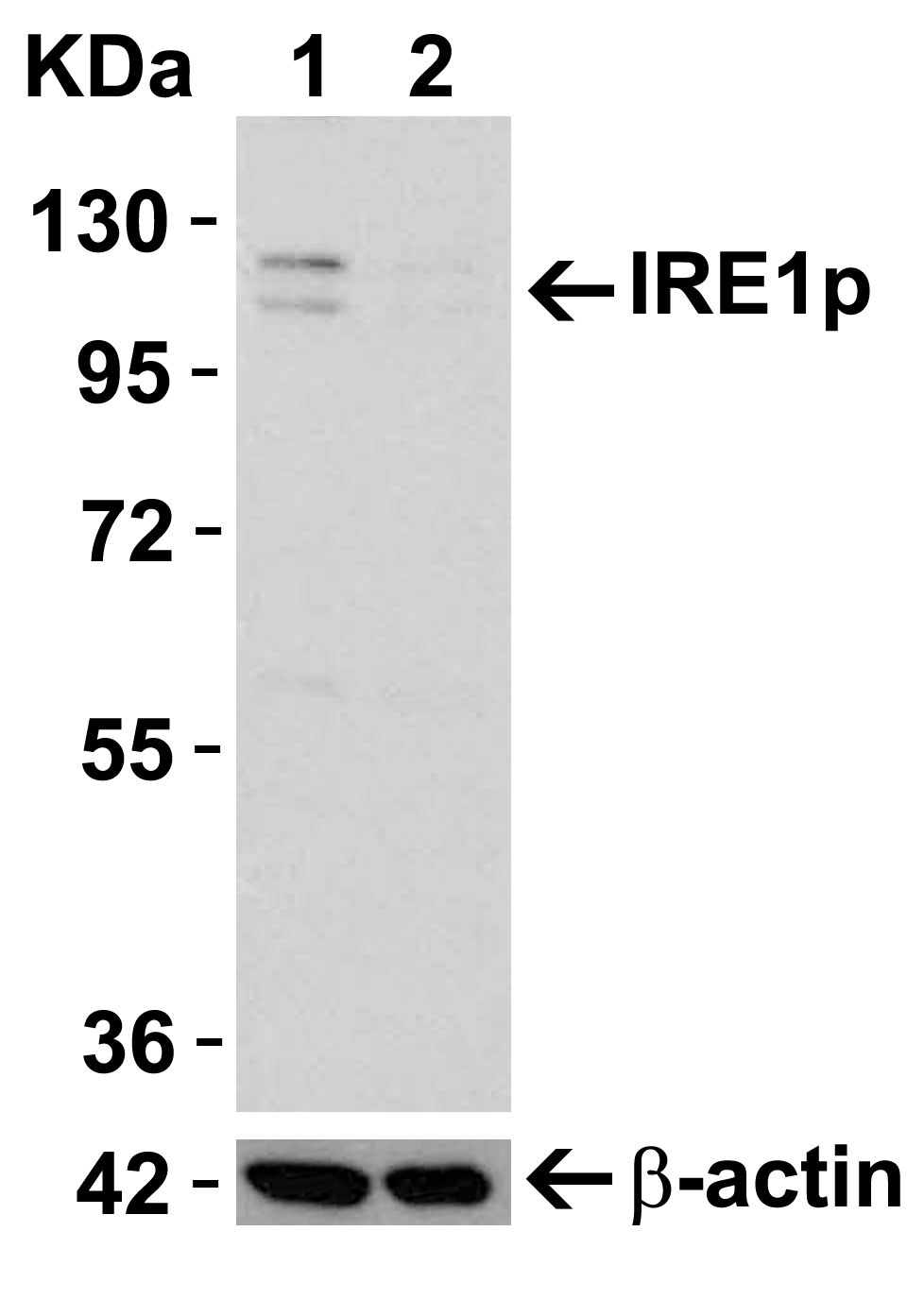 Anti-IRE1 alpha antibody (GTX30005) | GeneTex