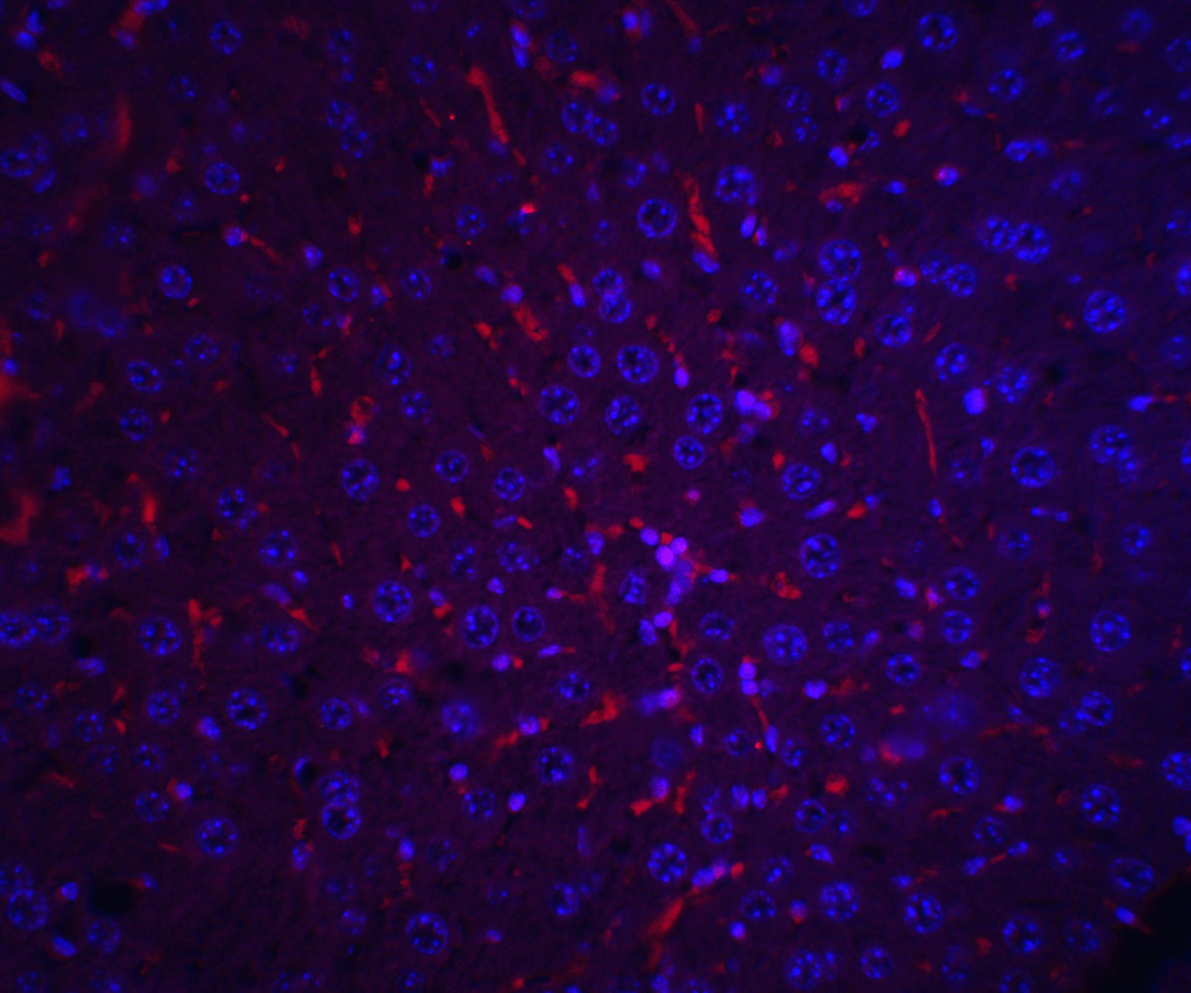 Anti-Alpha fetoprotein / AFP antibody (GTX31809) | GeneTex