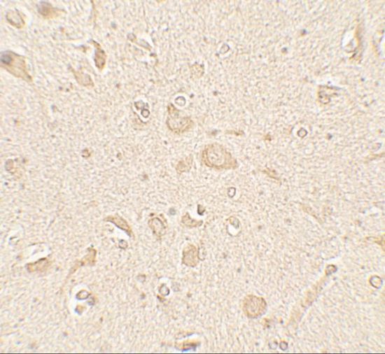 Anti-LC3B antibody (GTX31899) | GeneTex