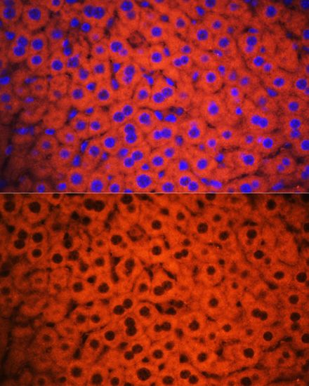 Anti-C3 / C3c antibody (GTX33050) | GeneTex