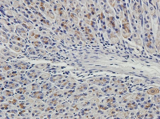 Anti-CD163 antibody (GTX35248) | GeneTex