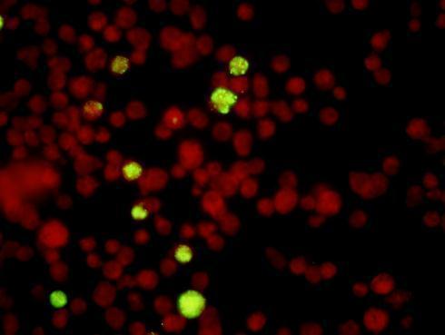 Anti-EBV VCA antibody [0231] (GTX36646) | GeneTex