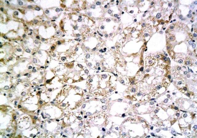 Anti-Fibronectin antibody (GTX37694) | GeneTex