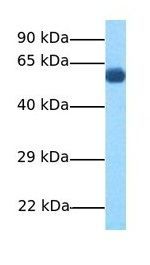 Anti-DMT1 antibody, N-term (GTX46861) | GeneTex
