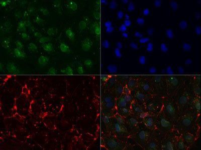 Anti-SSEA-1 / CD15 antibody [MC-480] (GTX48035) | GeneTex