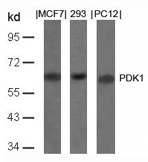 Anti-PDPK1 / PDK1 antibody (GTX50366) | GeneTex
