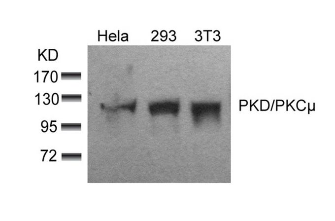 Anti-PKC mu antibody (GTX50473) | GeneTex