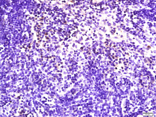 Anti-NKG2D antibody (GTX50988) | GeneTex
