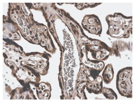 Anti-MMP3 antibody [3E44] (GTX52474) | GeneTex