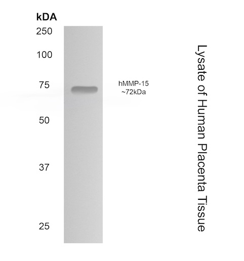 Anti-MMP15 antibody [5D11] (GTX52481) | GeneTex