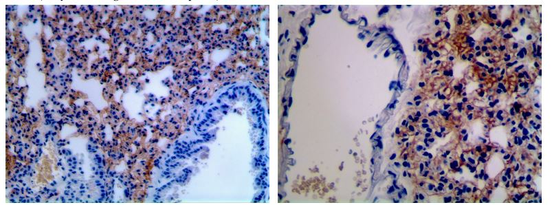 Anti-CD86 antibody [MAB0803] (GTX53134) | GeneTex