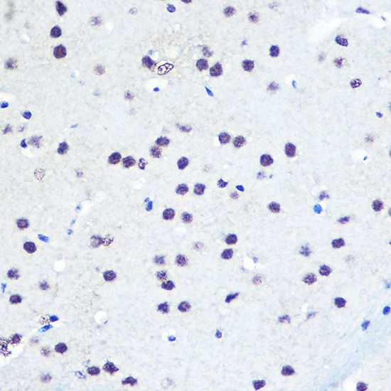 Anti-NFkB p65 (phospho Ser276) antibody (GTX54672) | GeneTex