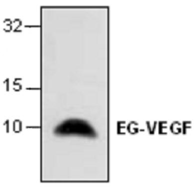 Anti-EG-VEGF antibody (GTX59727) | GeneTex