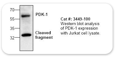 Anti-PDPK1 / PDK1 antibody (GTX59809) | GeneTex