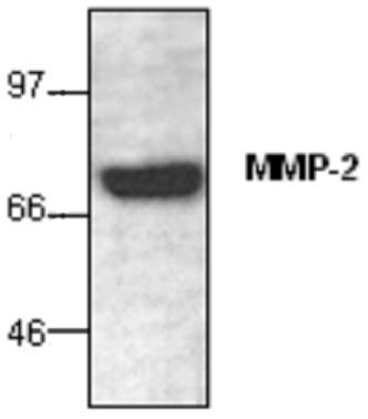 Anti-MMP2 antibody (GTX59880) | GeneTex