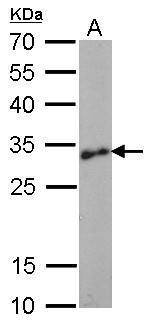 Anti-Lin28A antibody [GT1086] (GTX628139) | GeneTex