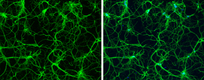 Anti-beta Tubulin 3/ Tuj1 antibody [GT11710] (GTX631836) | GeneTex