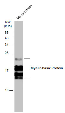 Anti-Myelin basic protein antibody [GT3412] (GTX634292) | GeneTex