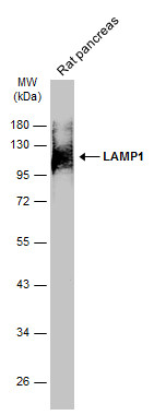 Anti-LAMP1 antibody [GT25212] (GTX634336) | GeneTex