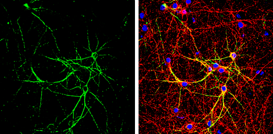 Anti-MAP2 antibody [GT925] (GTX634473) | GeneTex