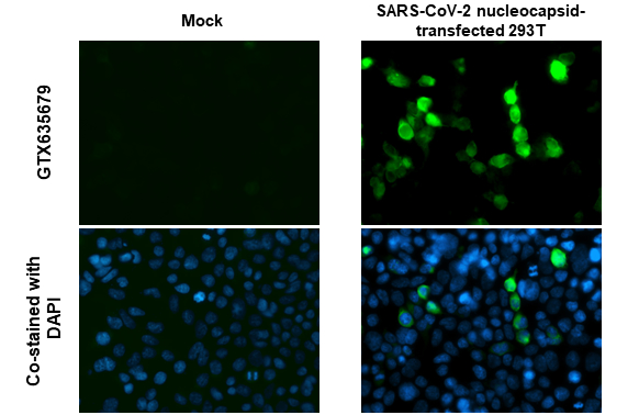 Anti-SARS-CoV-2 (COVID-19) Nucleocapsid antibody [HL344] (GTX635679) | GeneTex