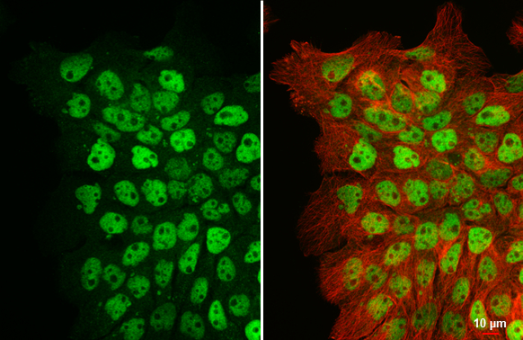Anti-p63 antibody [HL1027] (GTX635841) | GeneTex
